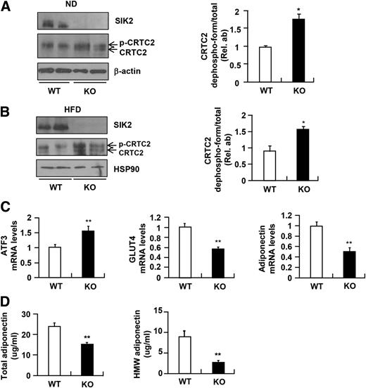 SIK2 Is Critical in the Regulation of Lipid Homeostasis and ...