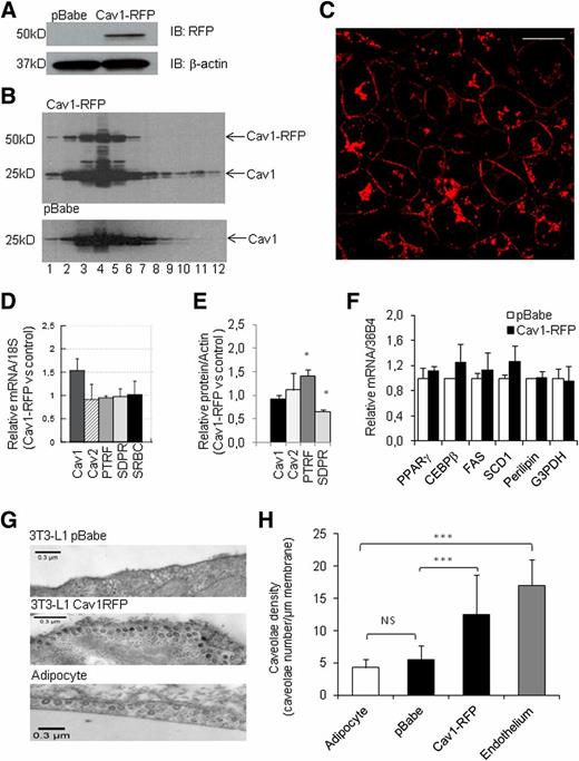 Caveolin-1 Expression and Cavin Stability Regulate Caveolae Dynamics in ...