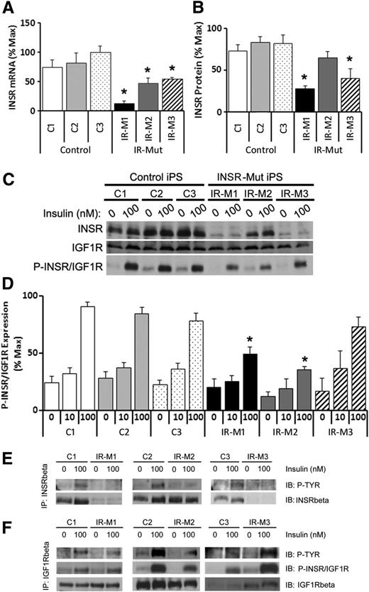 Genetic Insulin Resistance Is a Potent Regulator of Gene Expression and ...