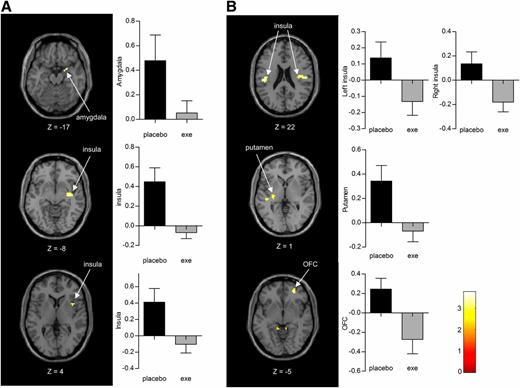 GLP-1 Receptor Activation Modulates Appetite- and Reward-Related Brain ...