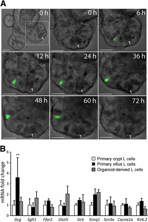 Generation of L Cells in Mouse and Human Small Intestine Organoids ...