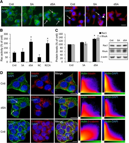 Deoxysphingolipids, Novel Biomarkers for Type 2 Diabetes, Are Cytotoxic ...