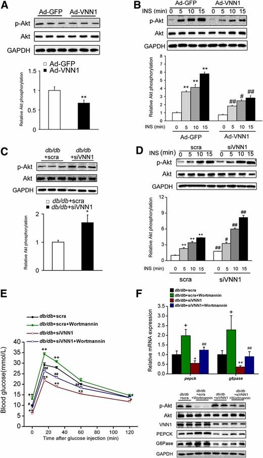 Vanin-1 Is a Key Activator for Hepatic Gluconeogenesis | Diabetes ...