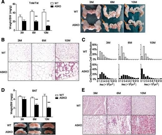 Adipose-Specific Knockout of Seipin/Bscl2 Results in Progressive ...