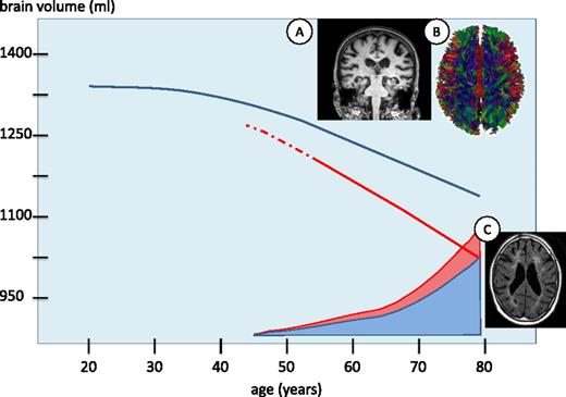 Brain Changes Underlying Cognitive Dysfunction in Diabetes: What Can We ...