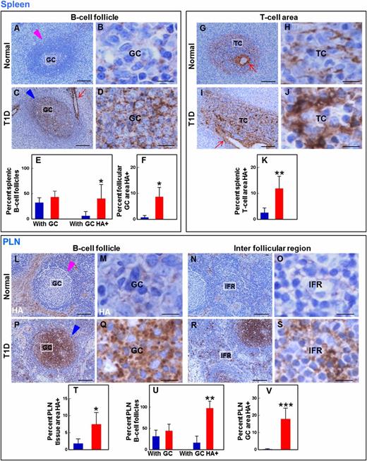 Hyaluronan and Hyaluronan-Binding Proteins Accumulate in Both Human ...
