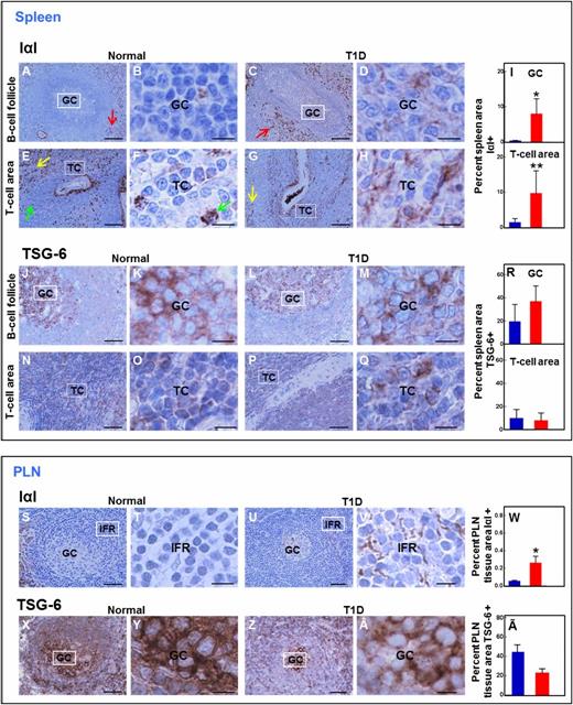 Hyaluronan and Hyaluronan-Binding Proteins Accumulate in Both Human ...