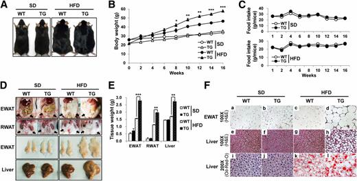 Triggering Receptor Expressed on Myeloid Cells 2 (TREM2) Promotes ...