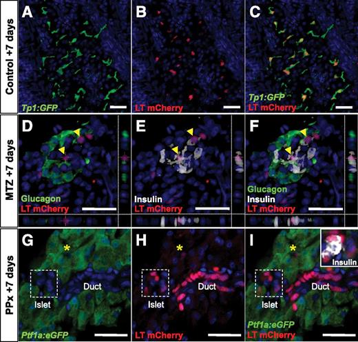 Centroacinar Cells Are Progenitors That Contribute to Endocrine ...