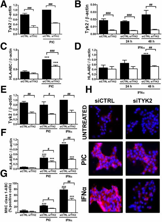 TYK2, a Candidate Gene for Type 1 Diabetes, Modulates Apoptosis and the ...