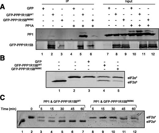 A Missense Mutation in PPP1R15B Causes a Syndrome Including Diabetes ...