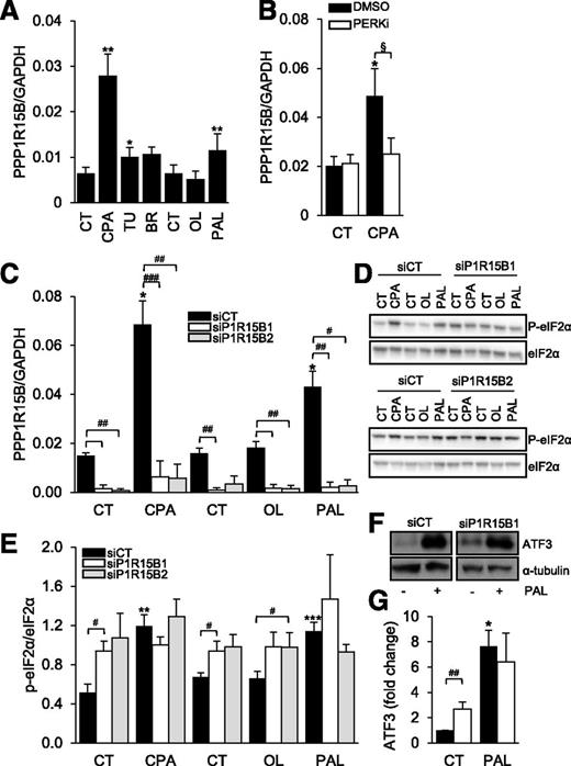 A Missense Mutation in PPP1R15B Causes a Syndrome Including Diabetes ...