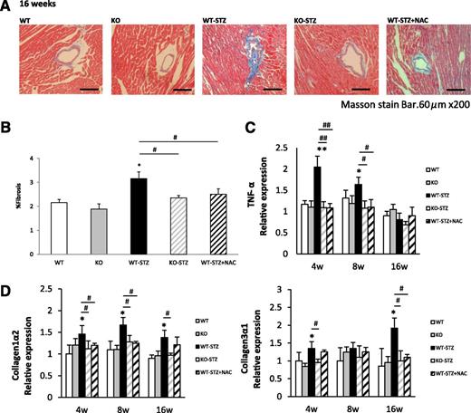 Arachidonate 12/15-Lipoxygenase–Induced Inflammation and Oxidative ...