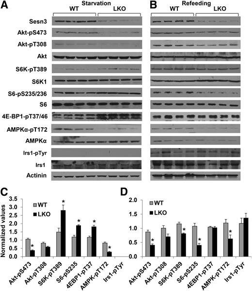 Sestrin 3 Protein Enhances Hepatic Insulin Sensitivity by Direct ...