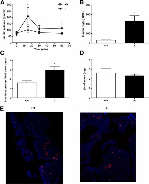 Loss of Cyp8b1 Improves Glucose Homeostasis by Increasing GLP-1 ...