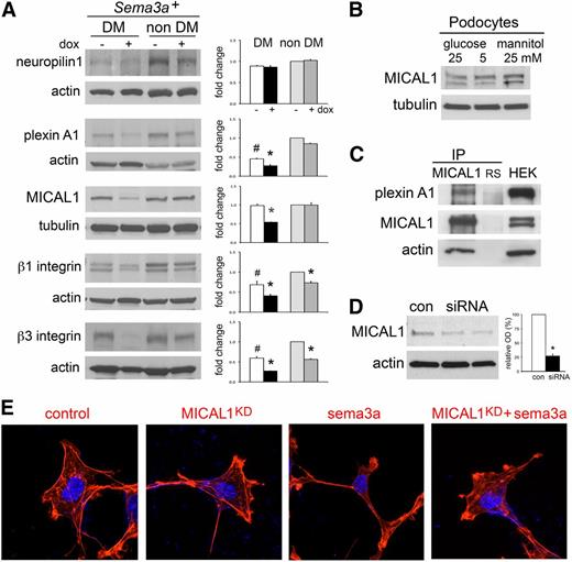 Semaphorin3a Promotes Advanced Diabetic Nephropathy | Diabetes ...