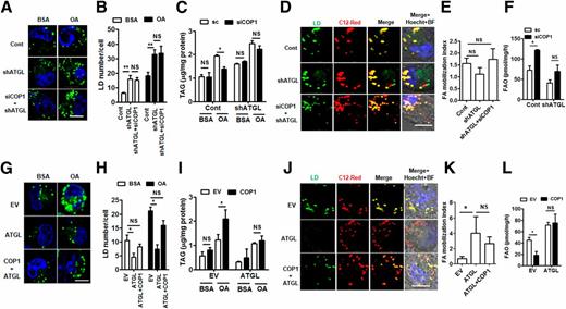 Ubiquitin Ligase COP1 Controls Hepatic Fat Metabolism by Targeting ATGL ...