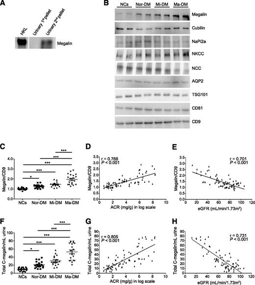 Exocytosis-Mediated Urinary Full-Length Megalin Excretion Is Linked ...