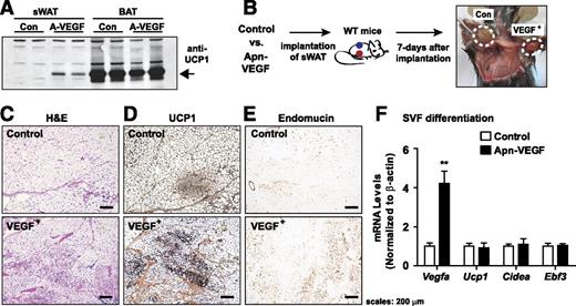 VEGF-A–Expressing Adipose Tissue Shows Rapid Beiging and Enhanced ...