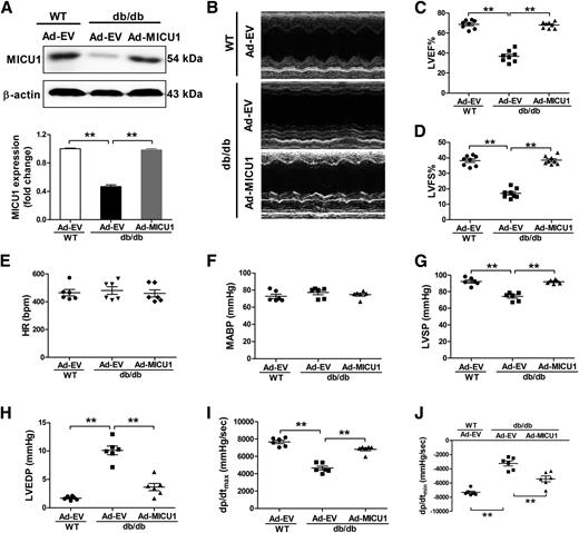 MICU1 Alleviates Diabetic Cardiomyopathy Through Mitochondrial Ca2 ...