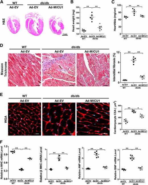 MICU1 Alleviates Diabetic Cardiomyopathy Through Mitochondrial Ca2 ...