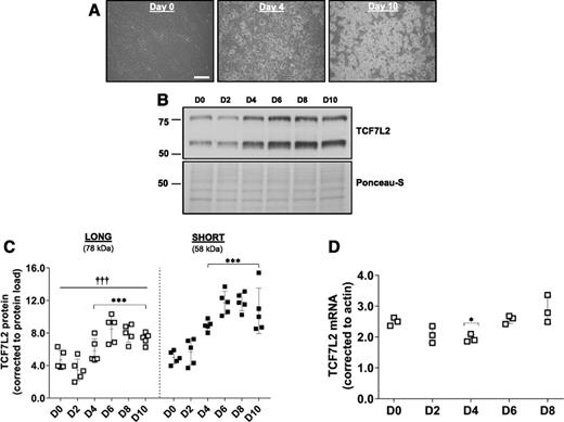 The Diabetes Gene and Wnt Pathway Effector TCF7L2 Regulates Adipocyte ...