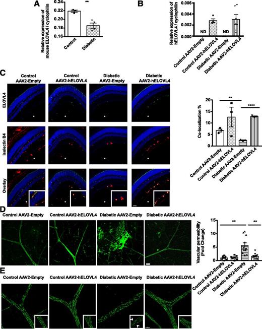ELOVL4-Mediated Production of Very Long-Chain Ceramides Stabilizes ...
