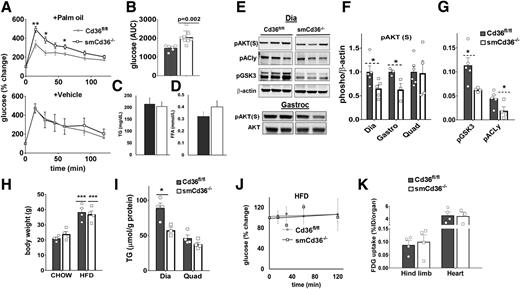 Regulation of Insulin Receptor Pathway and Glucose Metabolism by CD36 ...