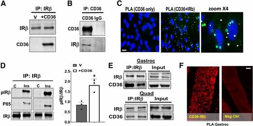 Regulation of Insulin Receptor Pathway and Glucose Metabolism by CD36 ...