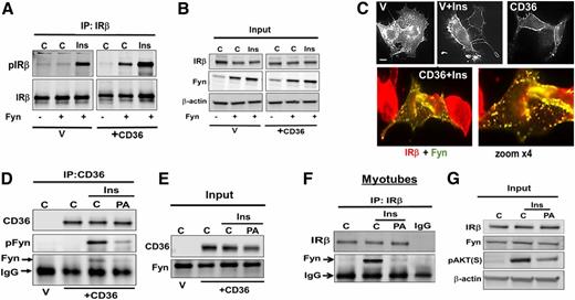 Regulation of Insulin Receptor Pathway and Glucose Metabolism by CD36 ...