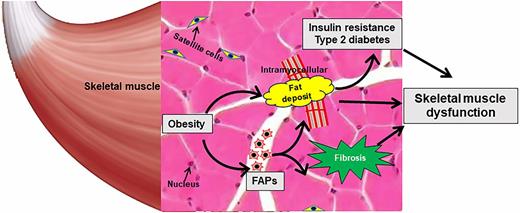 Increased Fibro-Adipogenic Progenitors and Intramyocellular Lipid ...