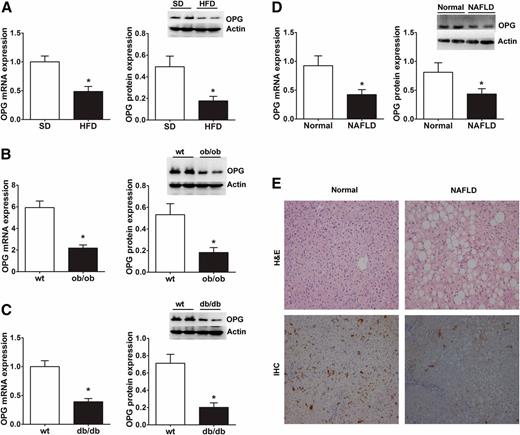 Osteoprotegerin Promotes Liver Steatosis by Targeting the ERK–PPAR-γ ...