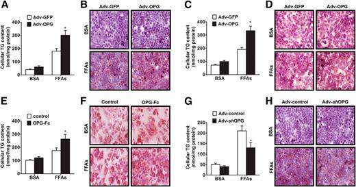 Osteoprotegerin Promotes Liver Steatosis by Targeting the ERK–PPAR-γ ...