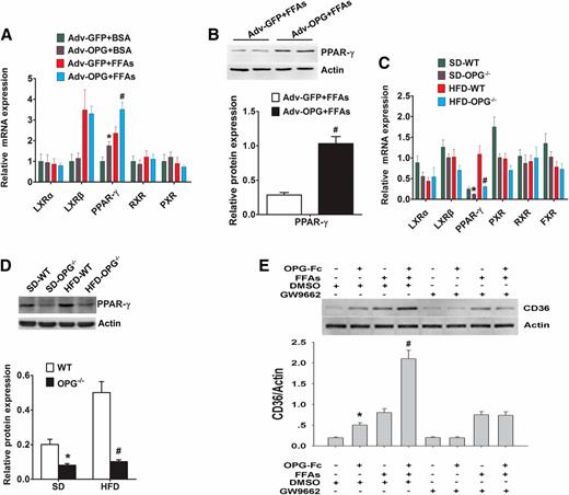 Osteoprotegerin Promotes Liver Steatosis by Targeting the ERK–PPAR-γ ...