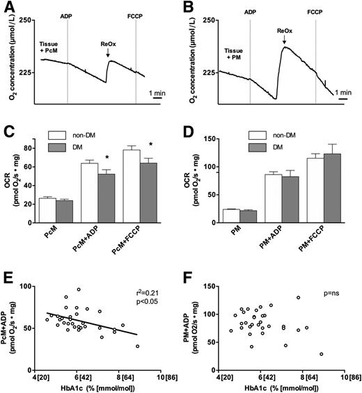 Disturbed Fatty Acid Oxidation, Endoplasmic Reticulum Stress, and ...