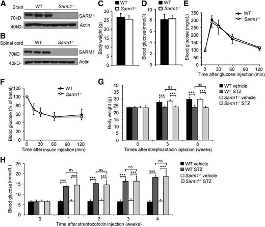 Sarm1 Gene Deficiency Attenuates Diabetic Peripheral Neuropathy in Mice ...