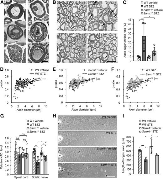 Sarm1 Gene Deficiency Attenuates Diabetic Peripheral Neuropathy in Mice ...
