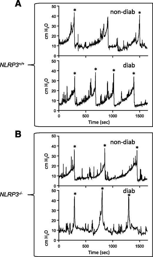 NLRP3 Promotes Diabetic Bladder Dysfunction and Changes in Symptom ...