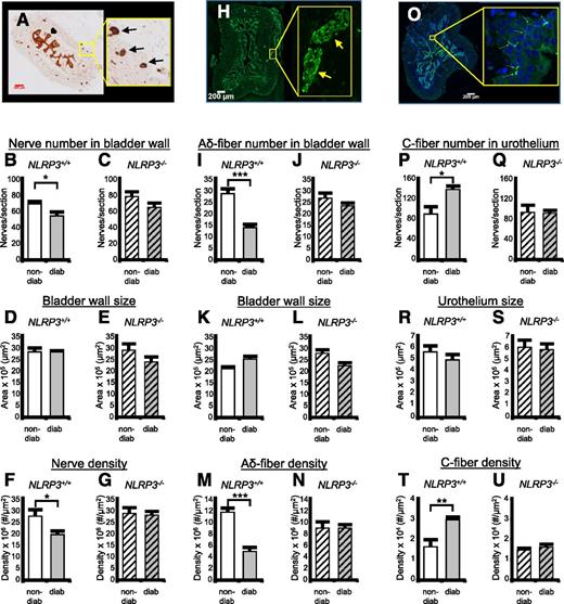 NLRP3 Promotes Diabetic Bladder Dysfunction and Changes in Symptom ...