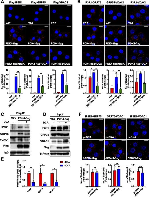 PDK4 Augments ER–Mitochondria Contact to Dampen Skeletal Muscle Insulin ...