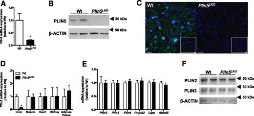 Perilipin 5 Deletion in Hepatocytes Remodels Lipid Metabolism and ...