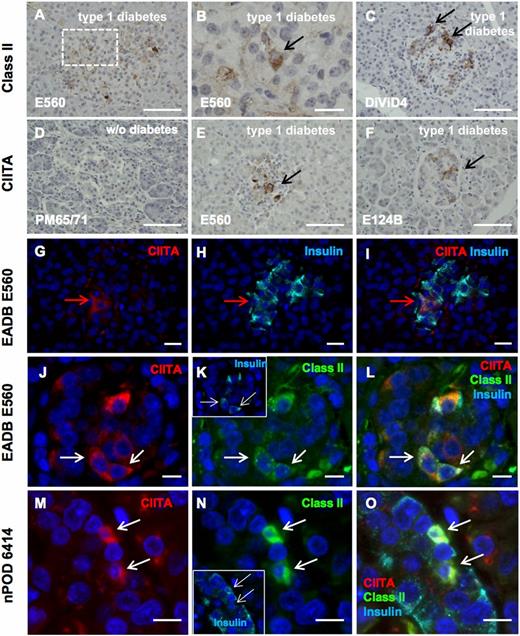 HLA Class II Antigen Processing and Presentation Pathway Components ...