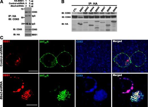 The BBSome in POMC and AgRP Neurons Is Necessary for Body Weight ...