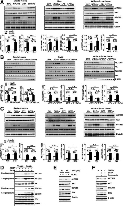 Targeting BCAA Catabolism to Treat Obesity-Associated Insulin ...