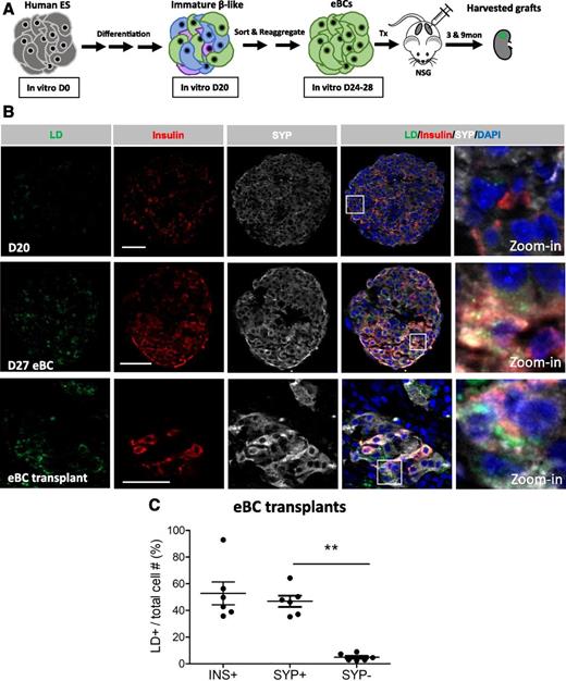 Lipid Droplet Accumulation in Human Pancreatic Islets Is Dependent On ...