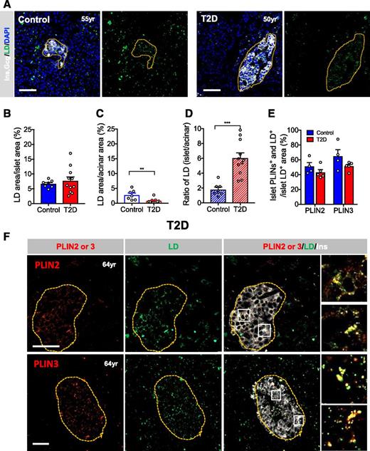 Lipid Droplet Accumulation in Human Pancreatic Islets Is Dependent On ...