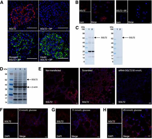 Interindividual Heterogeneity of SGLT2 Expression and Function in Human ...