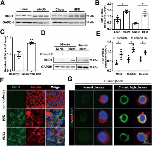 HRD1, an Important Player in Pancreatic β-Cell Failure and Therapeutic ...