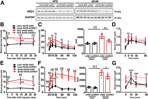 HRD1, an Important Player in Pancreatic β-Cell Failure and Therapeutic ...