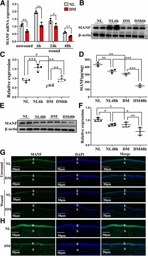 MANF Promotes Diabetic Corneal Epithelial Wound Healing and Nerve ...